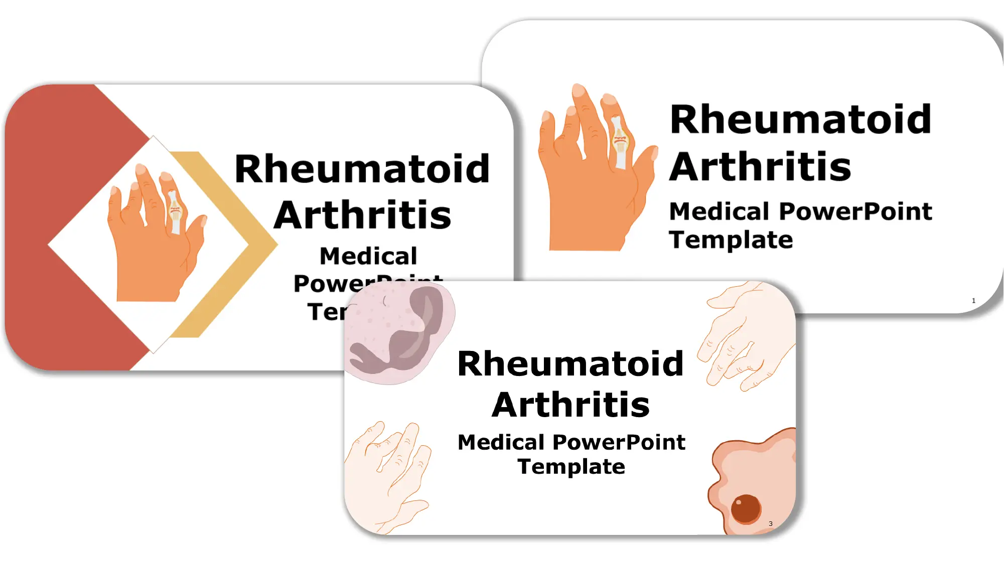 Download Rheumatoid Arthritis PowerPoint Template|RxSlides